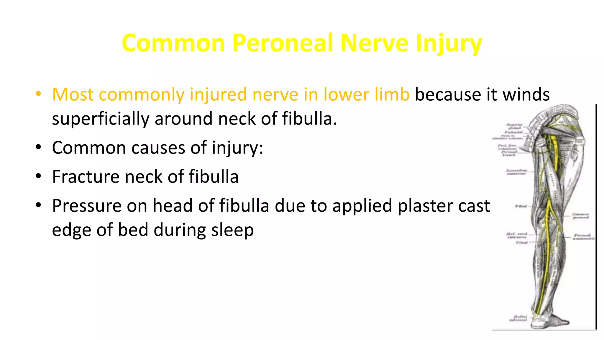 ANATOMY OF SCIATIC NERVE AND FOOT DROP | PPTX