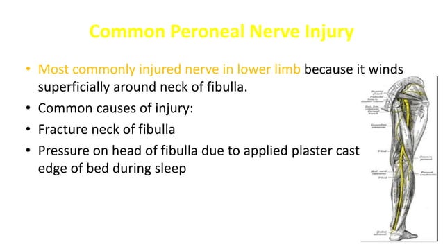 ANATOMY OF SCIATIC NERVE AND FOOT DROP | PPTX