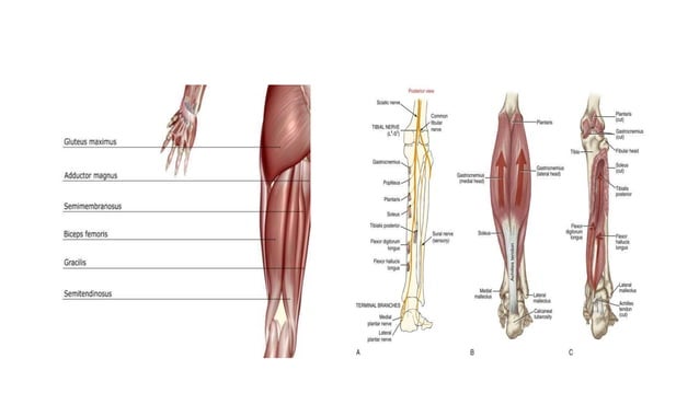 ANATOMY OF SCIATIC NERVE AND FOOT DROP | PPT