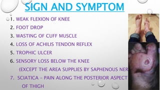 Sciatic nerve injury | PPTX