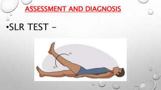 Sciatic nerve injury | PPTX