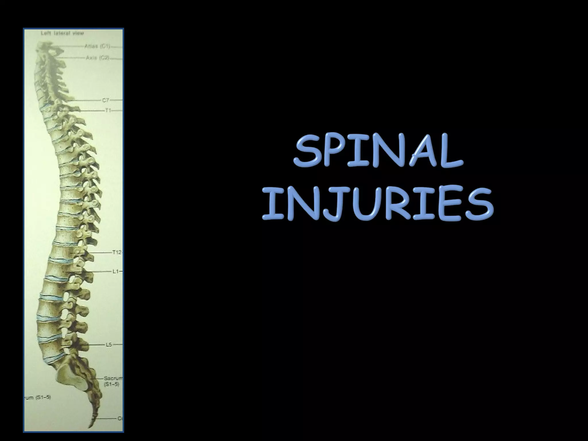 Spinal Injuries | PPT