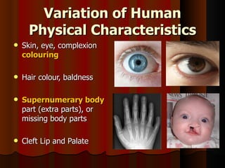 Science 9 Unit A Biological Diversity Section2 Lesson Variation | PPT