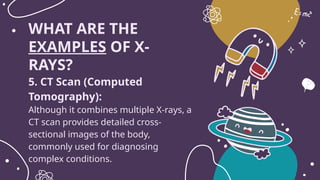 FULL EXPLANATION ABOUT X-RAYS GRADE 10 SCIENCE | PPTX