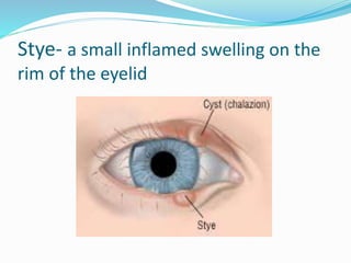 Science 3 parts of the eye | PPTX
