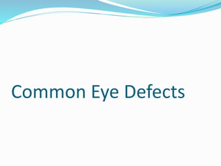 Science 3 parts of the eye | PPTX