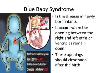 circulatory ailments | PPT
