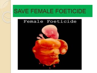 Female Foeticide | PPTX