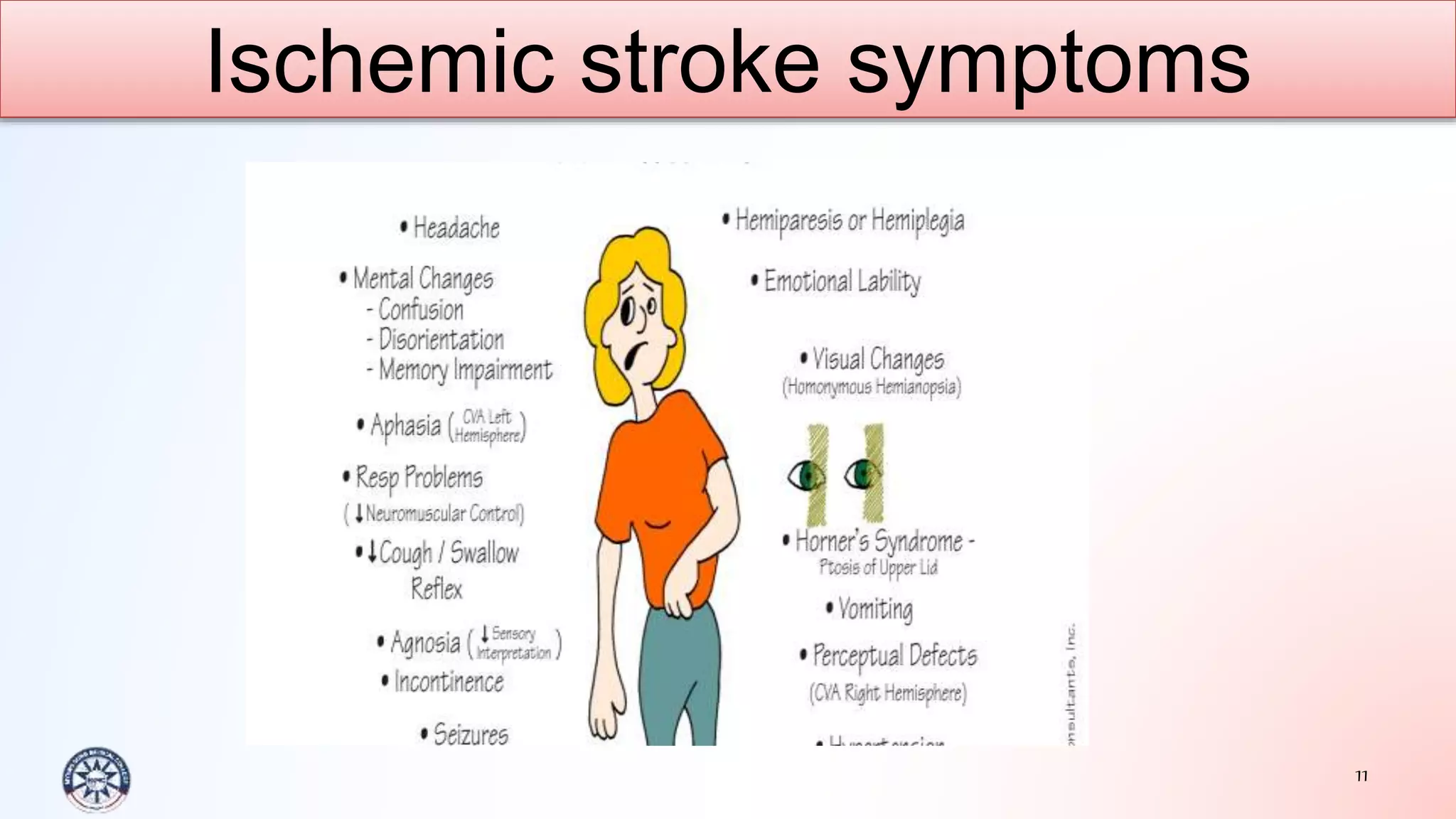 Management of stroke | PPTX