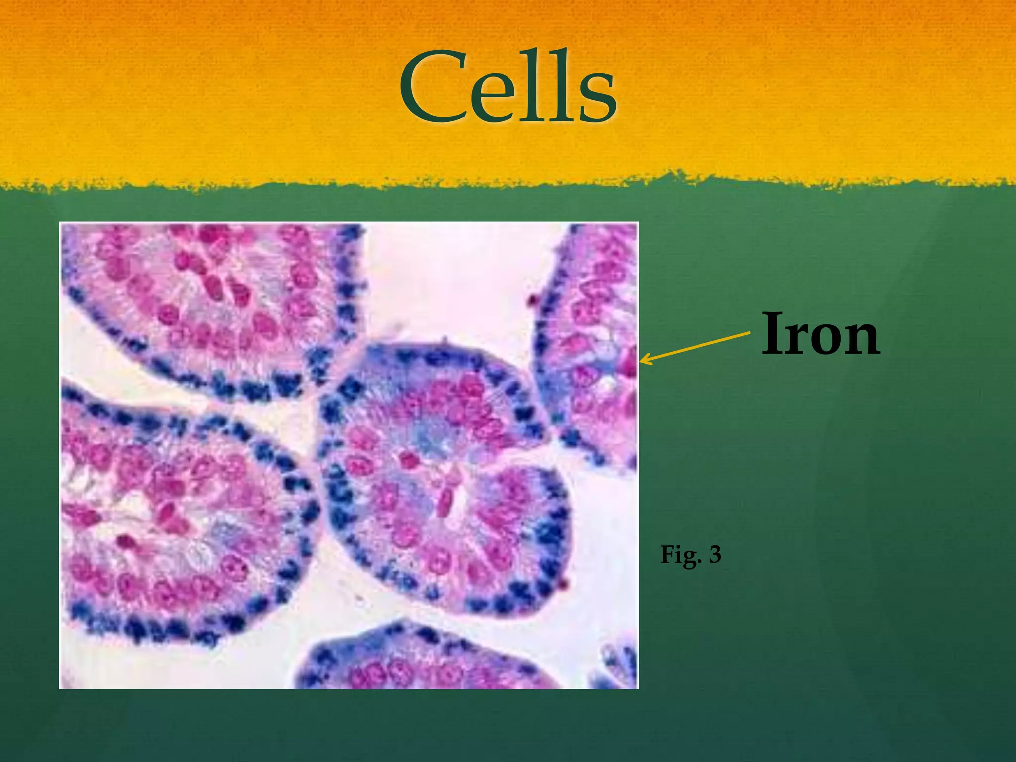 Science Iron Presentation | PPT
