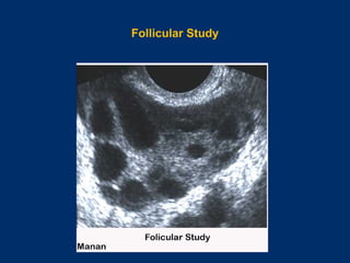 Science of fertility in human | PPT