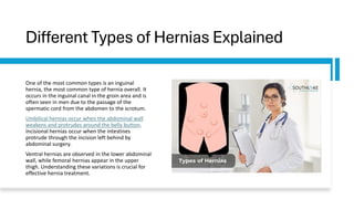 Science of Hernia Treatment - Expert Insights.pdf