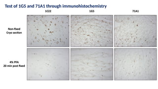 Opportunities and challenges of blood-based biomarkers in Alzheimer's ...