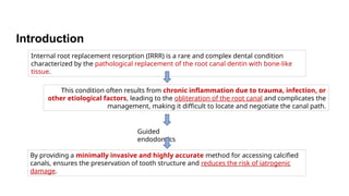 Scientific Award internal root resorptionguided endodontic.pptx