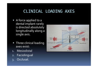 Scientific rationale and biomechanics in implants | PDF