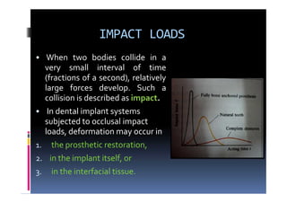 Scientific rationale and biomechanics in implants | PDF