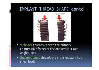 Scientific rationale and biomechanics in implants | PDF