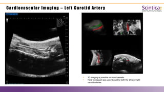 LIVE DEMONSTRATION: Understanding the Complimentary Nature of BLI ...