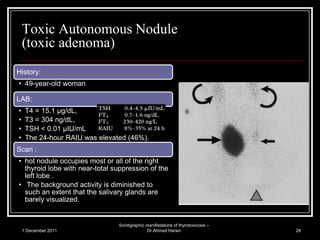 Scintigraphic manifistation of thyrotoxicosis | PPT