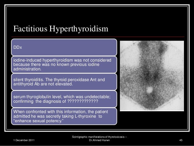 Scintigraphic manifistation of thyrotoxicosis