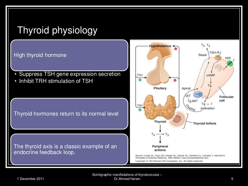 Scintigraphic manifistation of thyrotoxicosis