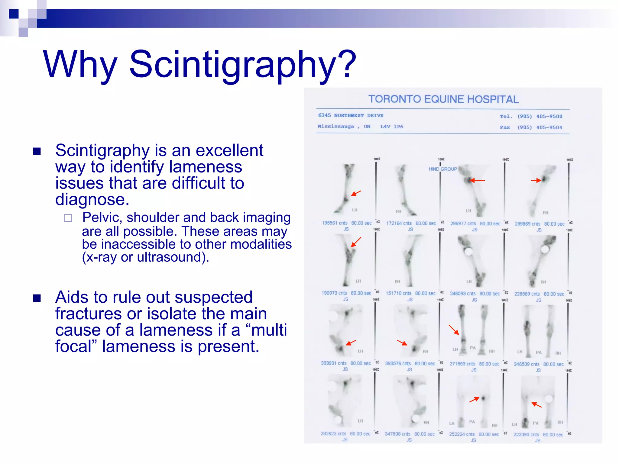 Scintigraphy | PDF