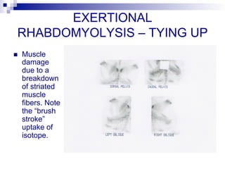 Scintigraphy | PDF