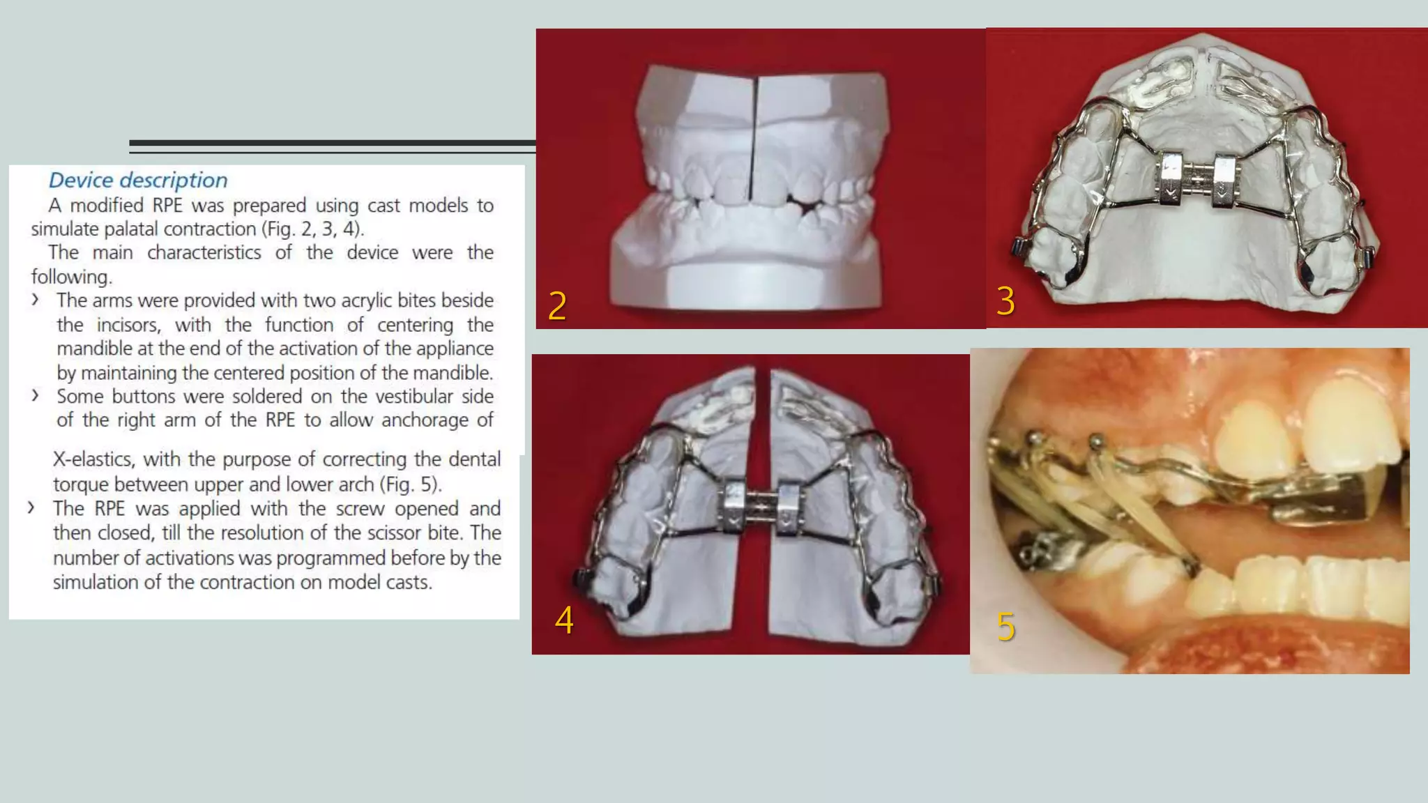 Scissor. telescope. brodie. bite | PPTX