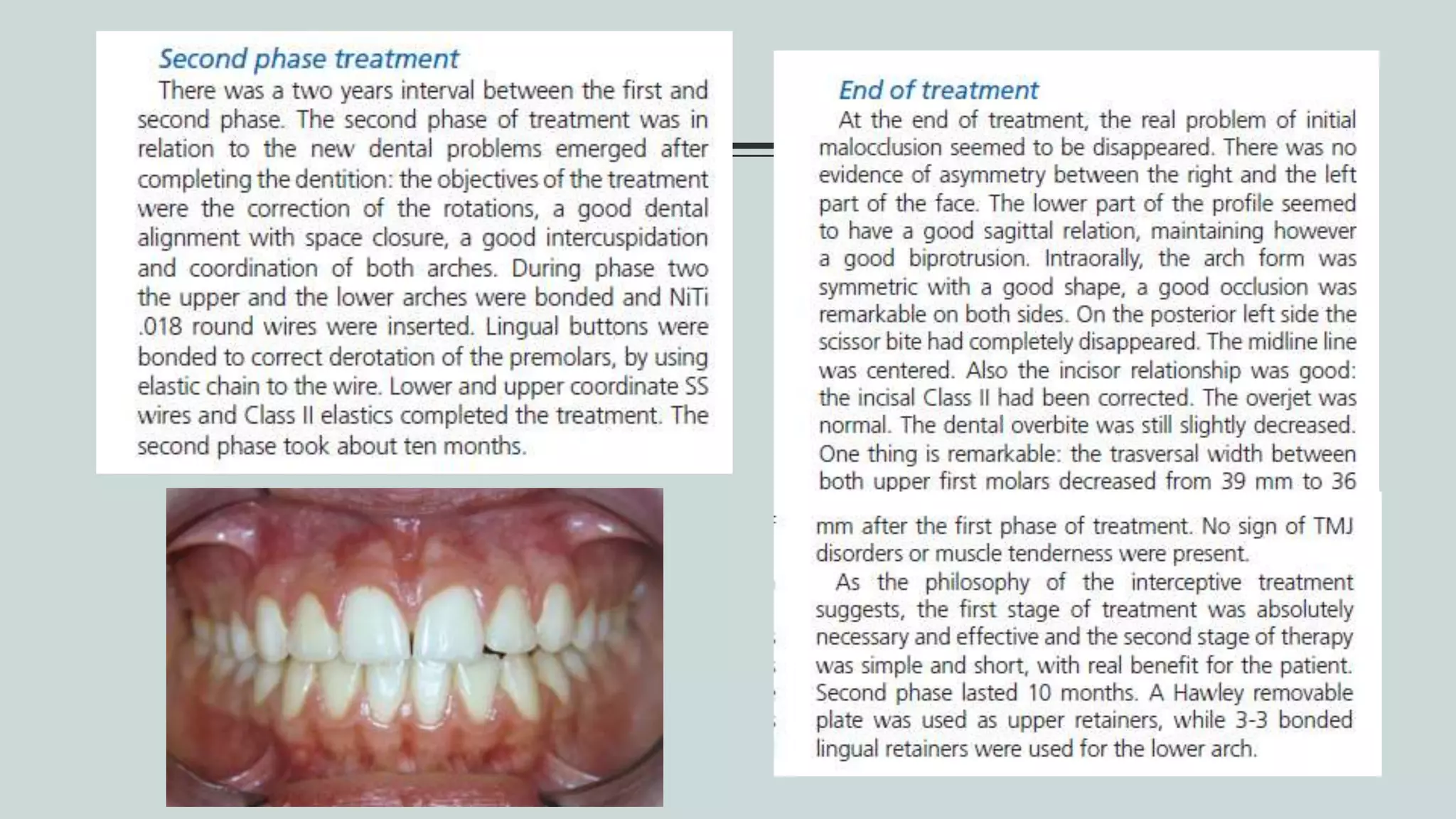 Scissor. telescope. brodie. bite | PPTX