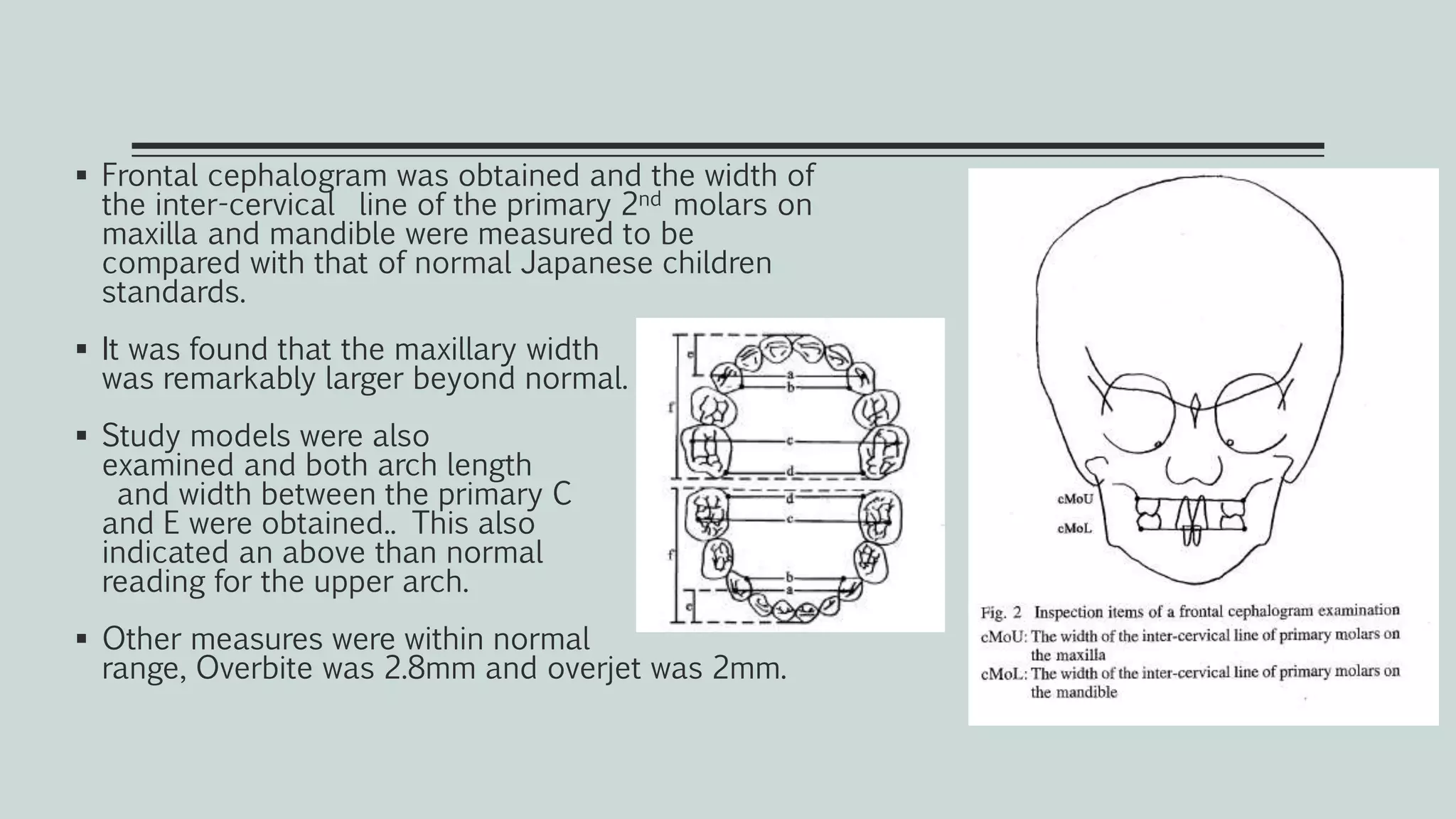 Scissor. telescope. brodie. bite | PPTX