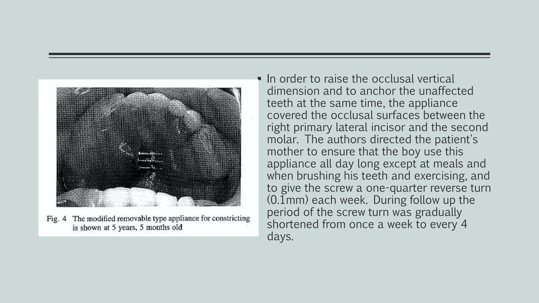Scissor. telescope. brodie. bite | PPTX