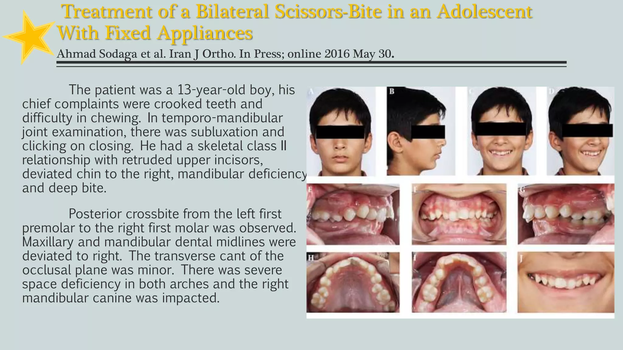 Scissor. telescope. brodie. bite | PPTX
