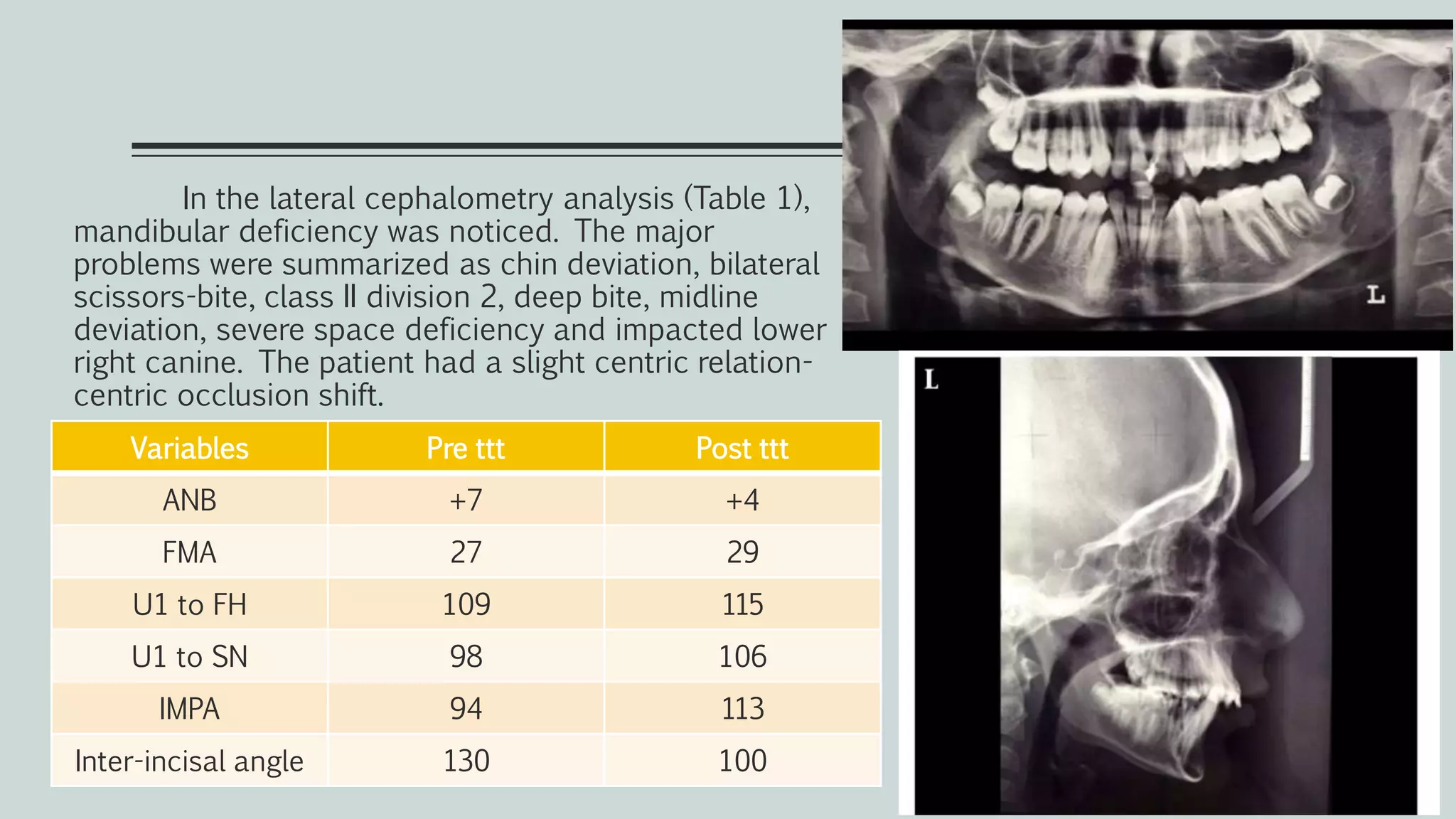 Scissor. telescope. brodie. bite | PPTX