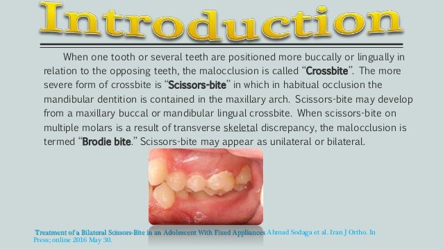 Scissor. telescope. brodie. bite