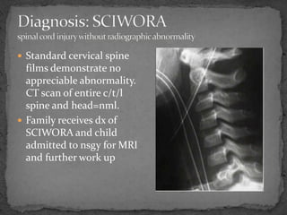 SCIWORA Power Point | PPTX