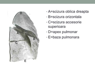 Scizurile accesorii ale plamanului prezentare pp | PPTX