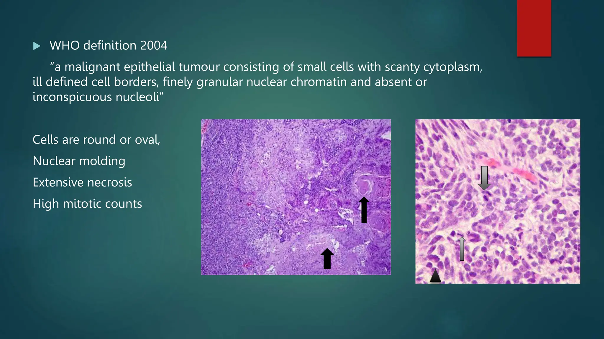 Small cell lung cancer staging and management | PPTX