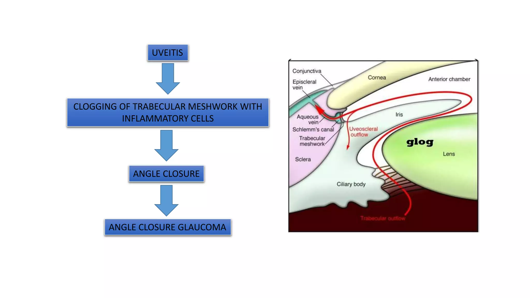 Episcleritis and scleritis | PPTX