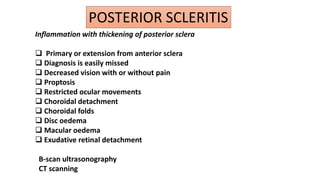 Episcleritis and scleritis | PPTX