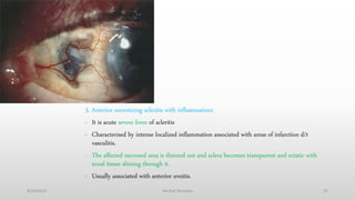 Sclera | PPT