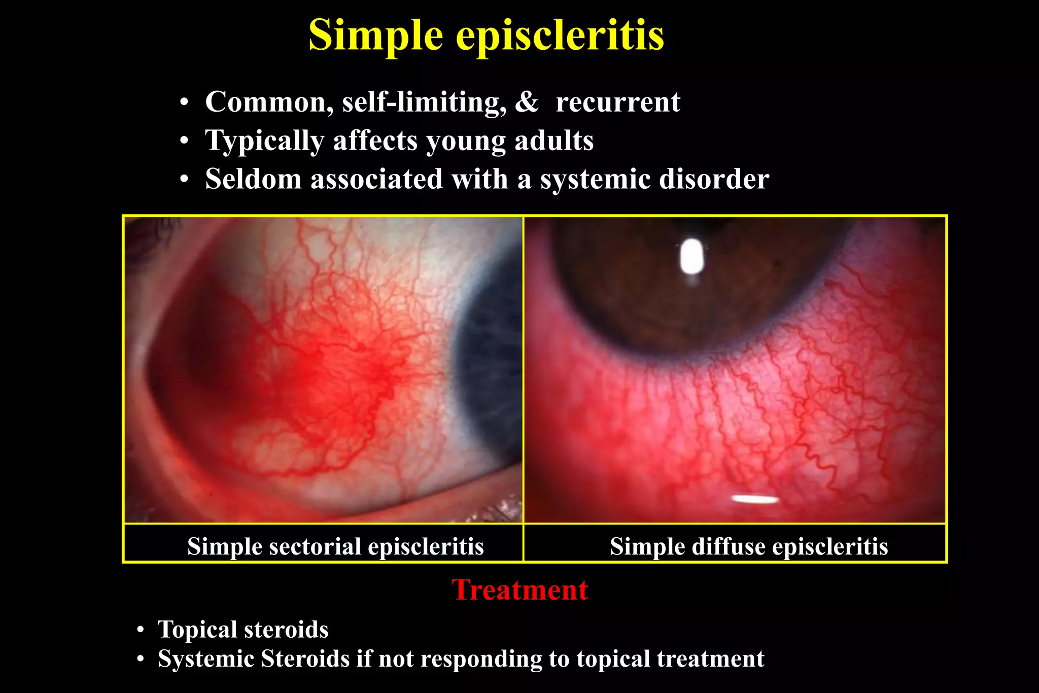 Sclera | PPT