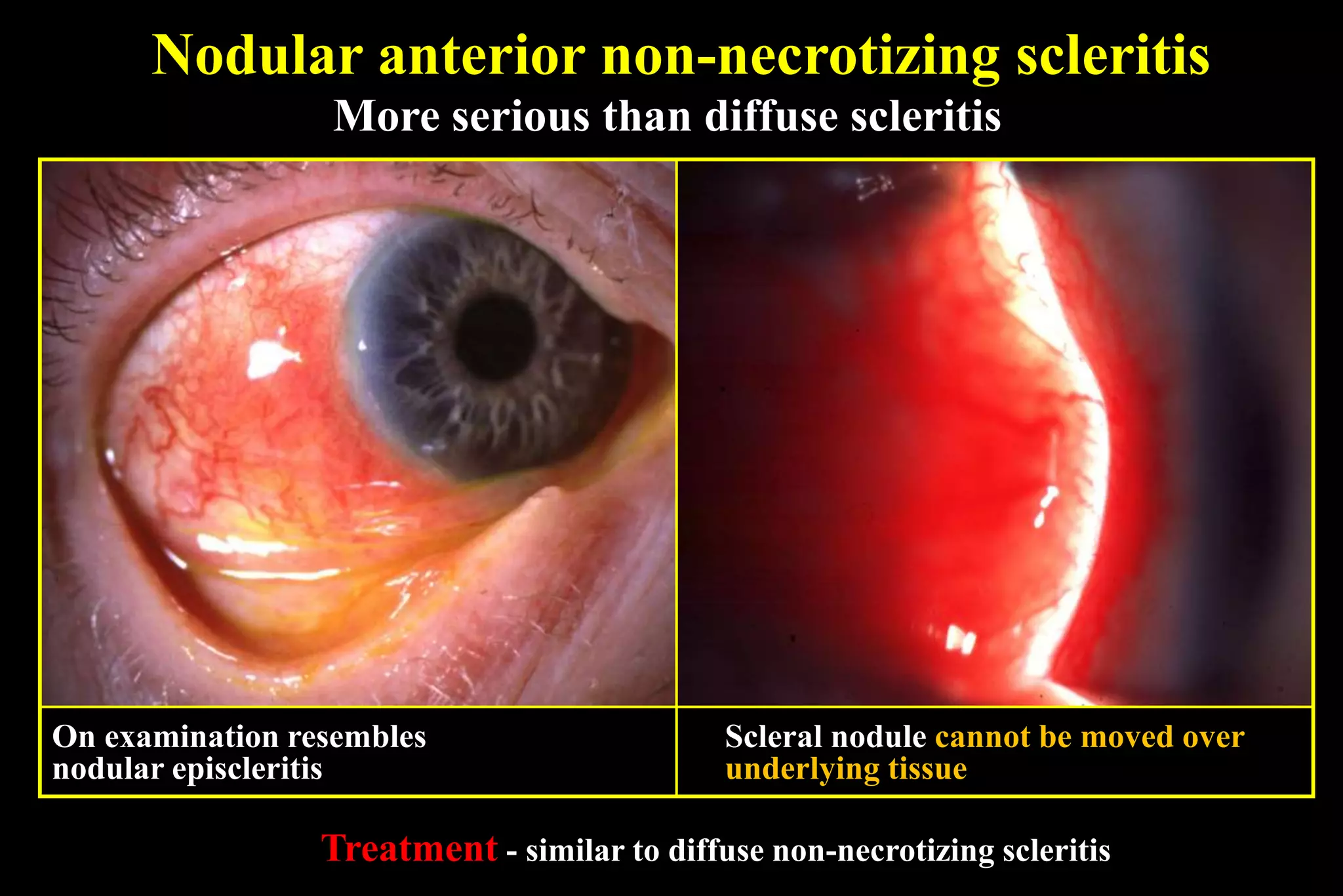 Sclera | PPT