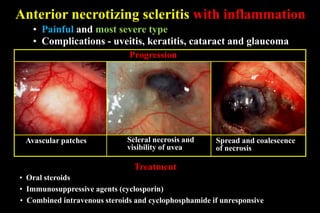 Sclera | PPT