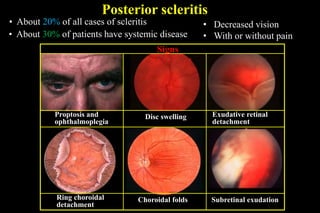 Sclera | PPT