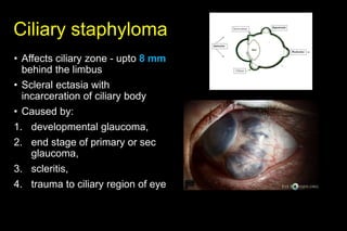 Sclera | PPT