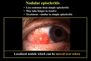 Sclera | PPT