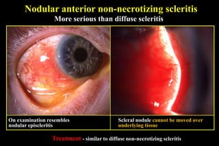 Sclera | PPT