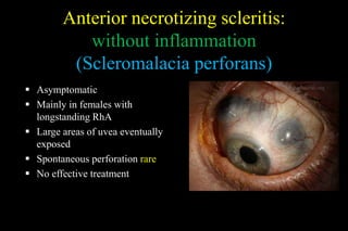Sclera | PPT