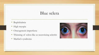 Sclera | PPT
