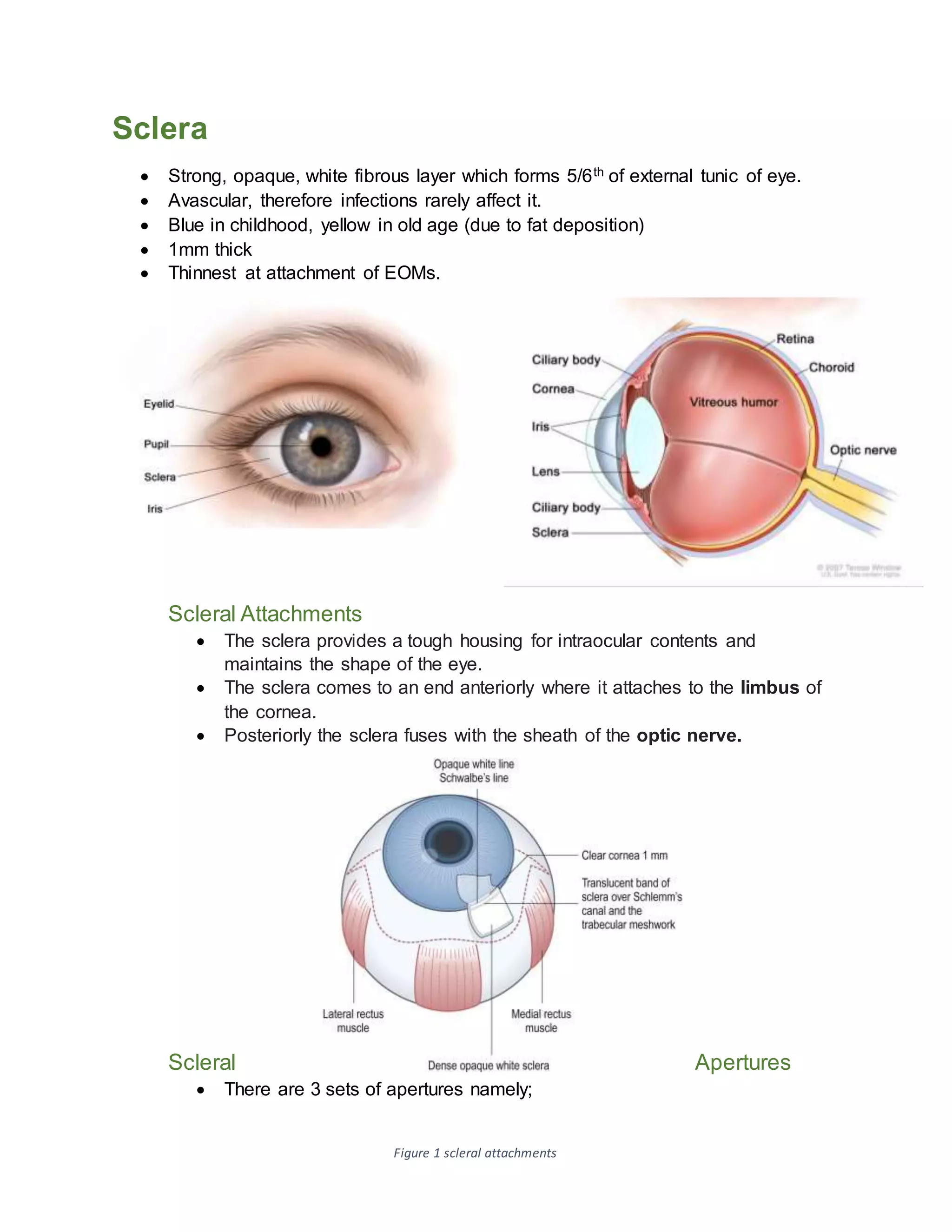 Sclera (scleritis and episcleritis, staphyloma) | DOCX